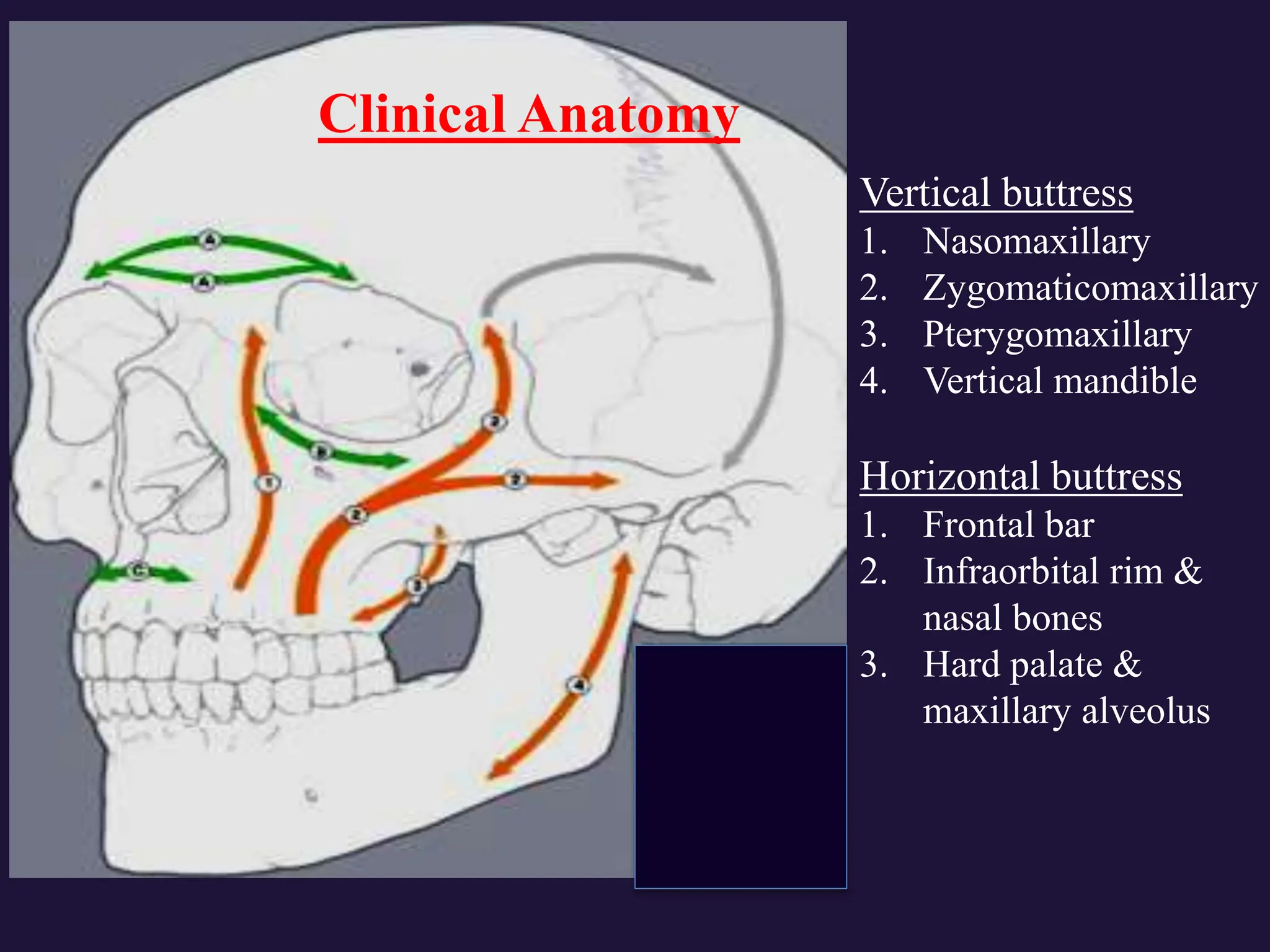 panfacial fractures- anatomy, clinical features, radiology.pptx