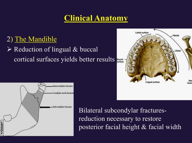panfacial fractures- anatomy, clinical features, radiology.pptx | Death ...