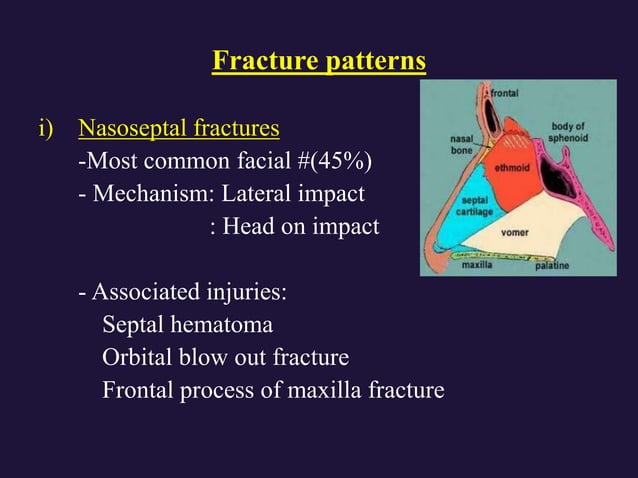 panfacial fractures- anatomy, clinical features, radiology.pptx | Death ...
