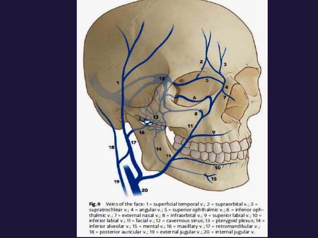 panfacial fractures- anatomy, clinical features, radiology.pptx | Death ...
