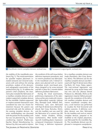 A technique for immediate occlusal implant loading of a completely ...