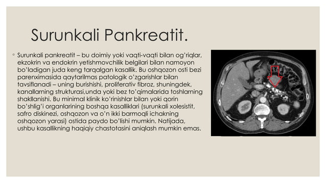 PANKREATIT DAVO REJA KLINIKA ETIOLOGY.pptx