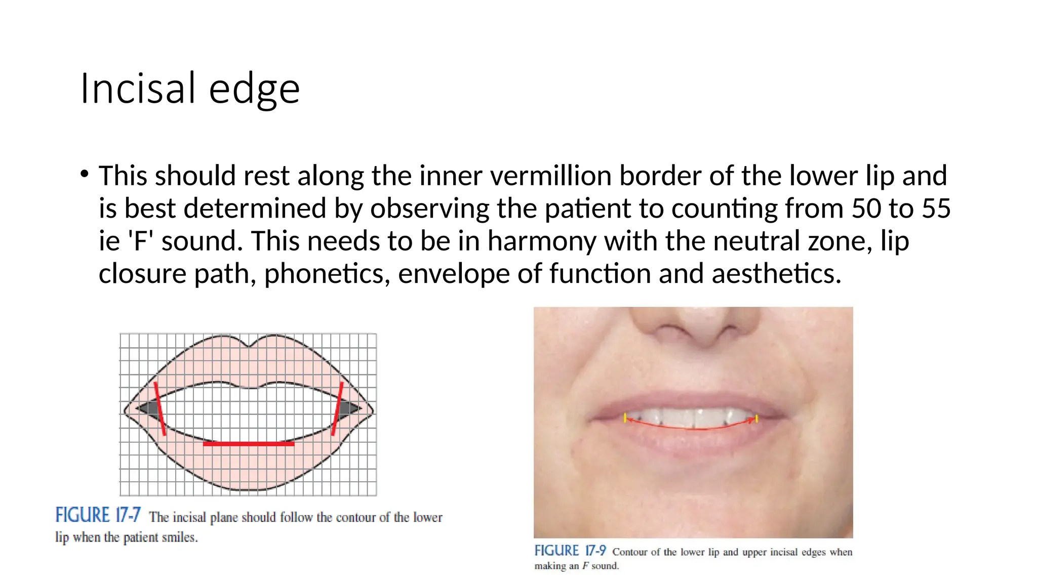 panky.pptx full mouth rehabilitation problem | PPTX
