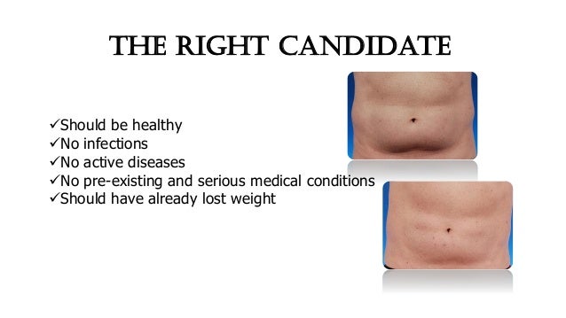 Panniculectomy by dr.tim