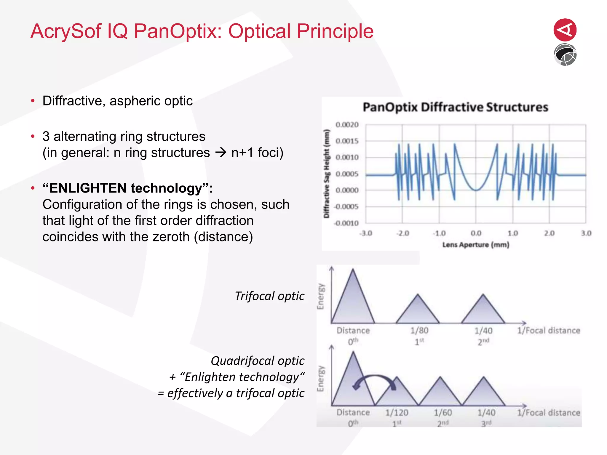 New Versus Former-Generation Diffractive Trifocal Intraocular Lens | PPTX