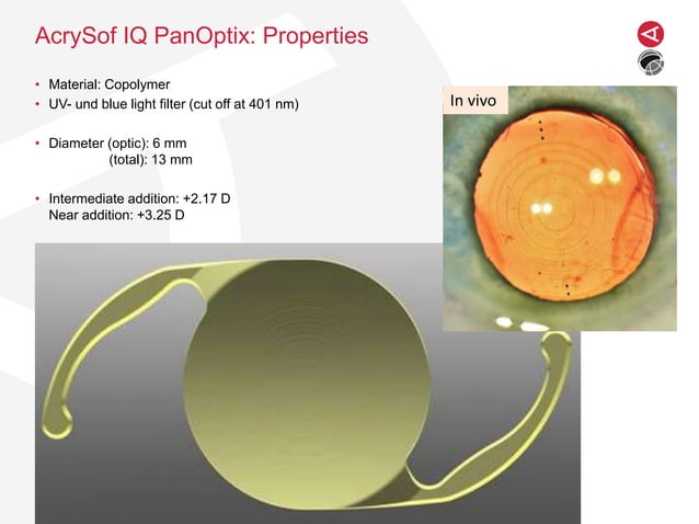 New Versus Former-Generation Diffractive Trifocal Intraocular Lens ...
