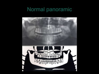 Panoramic-radiography.ppt