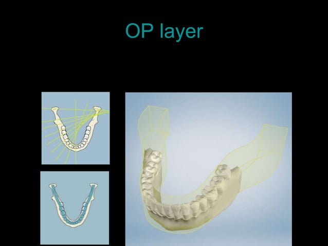 Panoramic-radiography.ppt | Dental Health | Diseases and Conditions