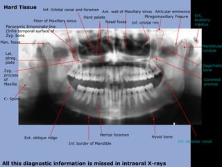 Panoramic-radiography.ppt