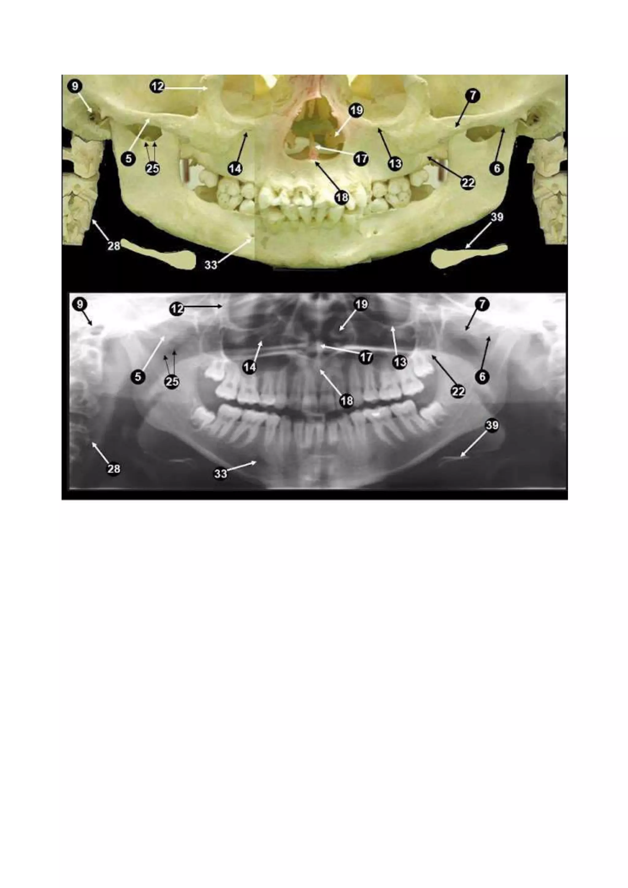 Panoramic anatomy | DOCX