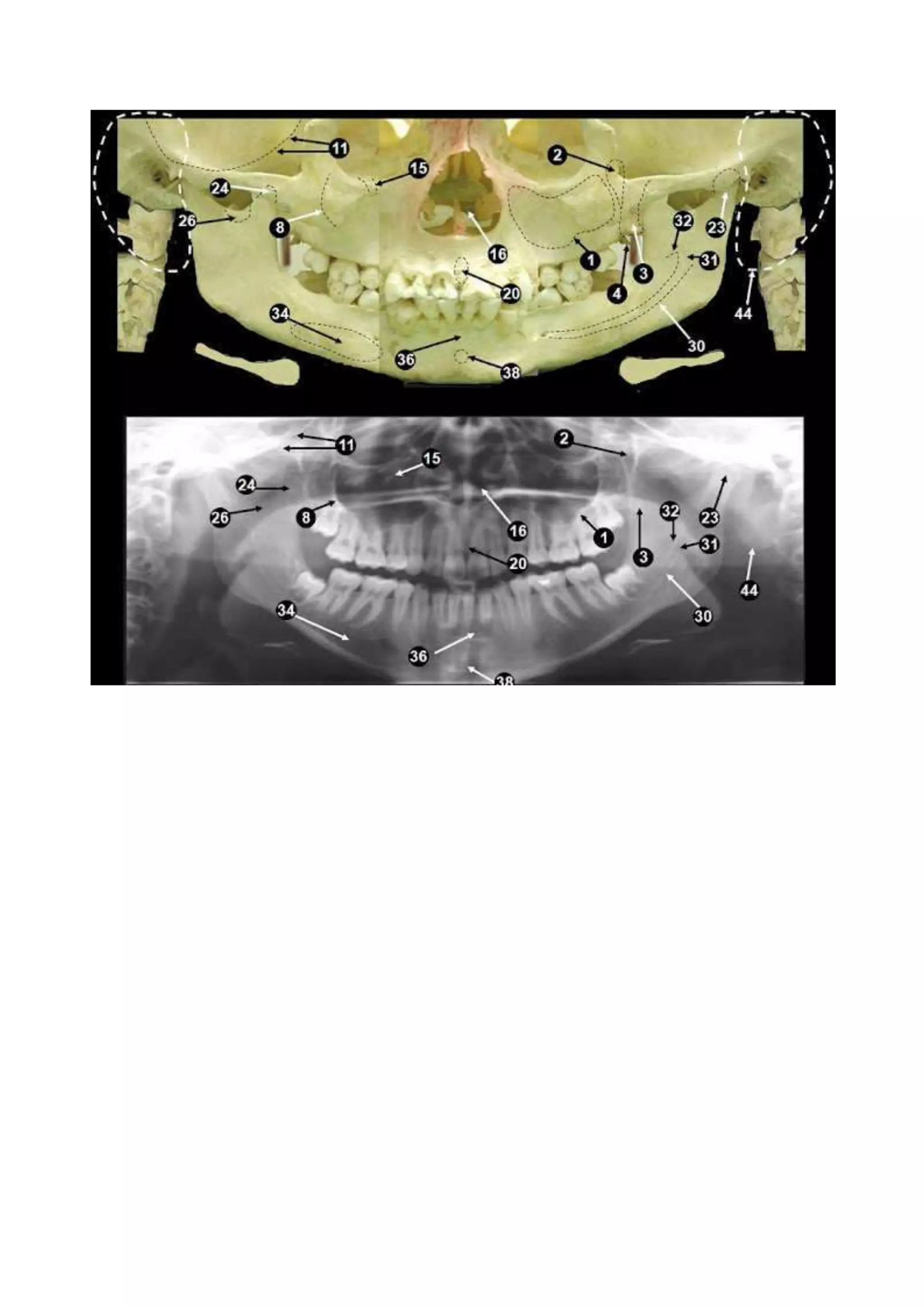 Panoramic anatomy | DOCX