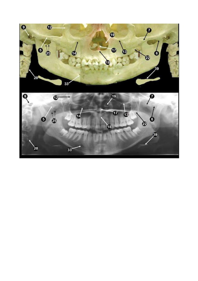 Panoramic anatomy | DOCX