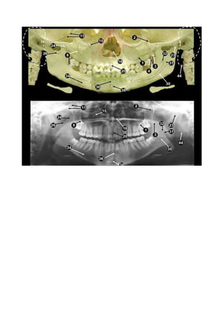 Panoramic anatomy | DOCX