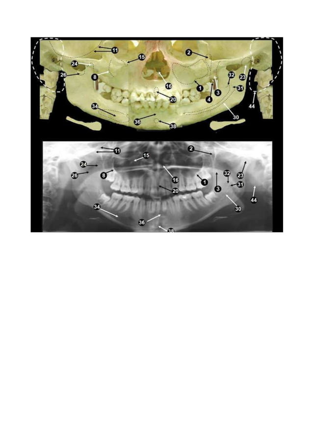 Panoramic anatomy | DOCX