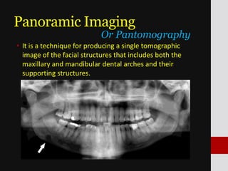 Panoramic imaging | PPTX | Dental Health | Diseases and Conditions