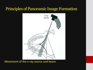 Panoramic imaging (1) | PPTX