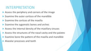 Panoramic radiograph | PPTX