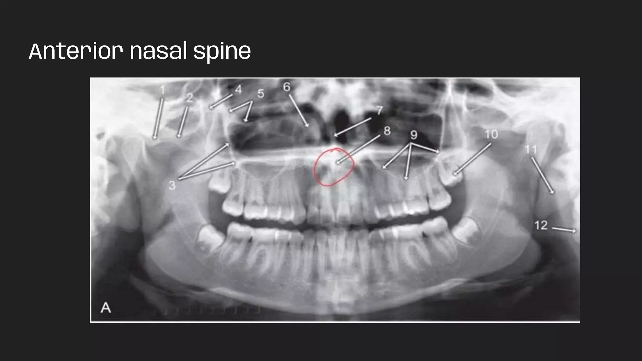 PANORAMIC RADIOGRAPHS .pdf