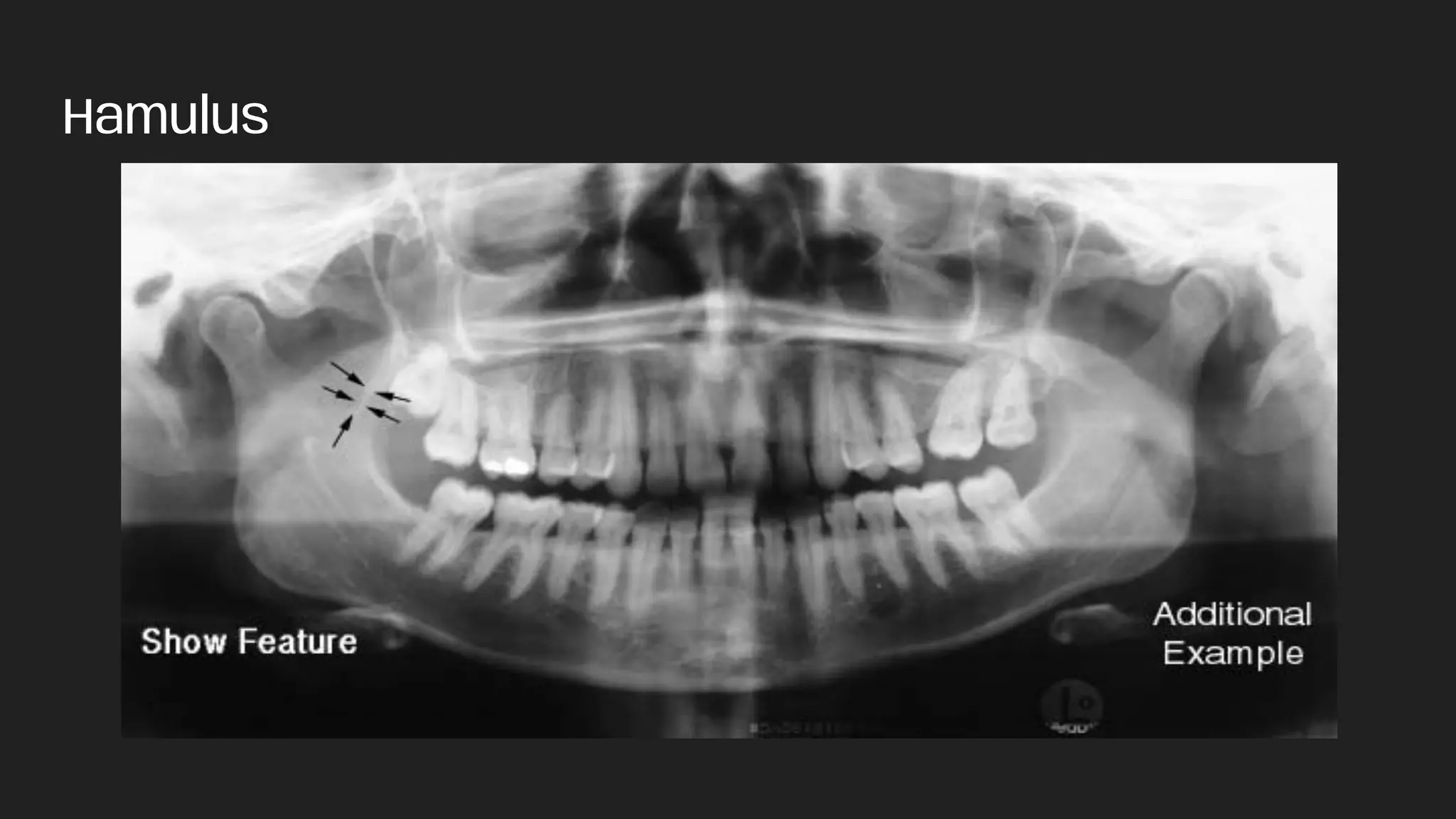 PANORAMIC RADIOGRAPHS .pdf