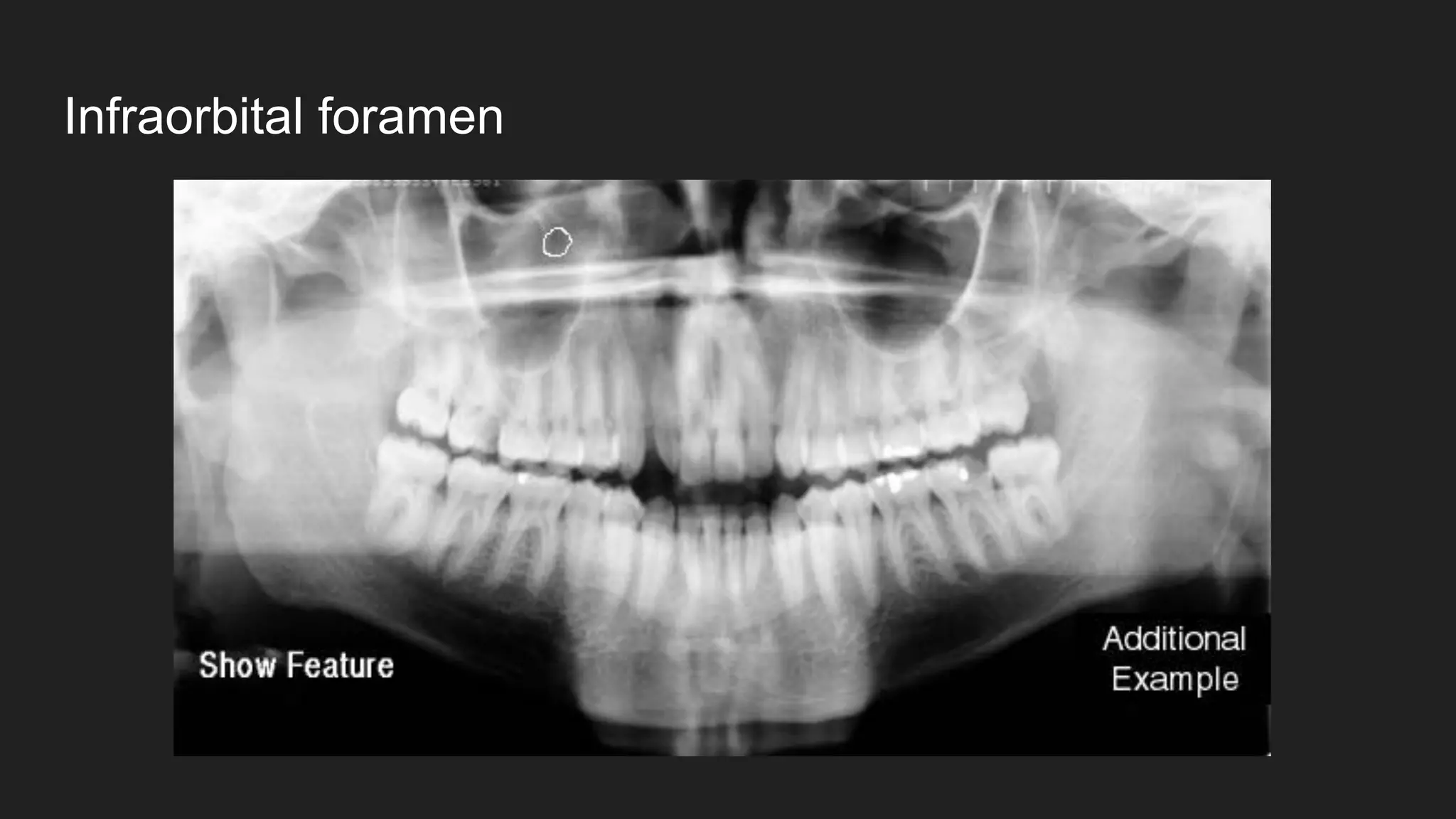PANORAMIC RADIOGRAPHS .pdf