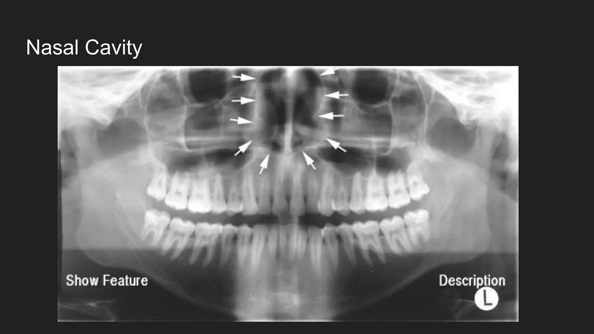 PANORAMIC RADIOGRAPHS .pdf