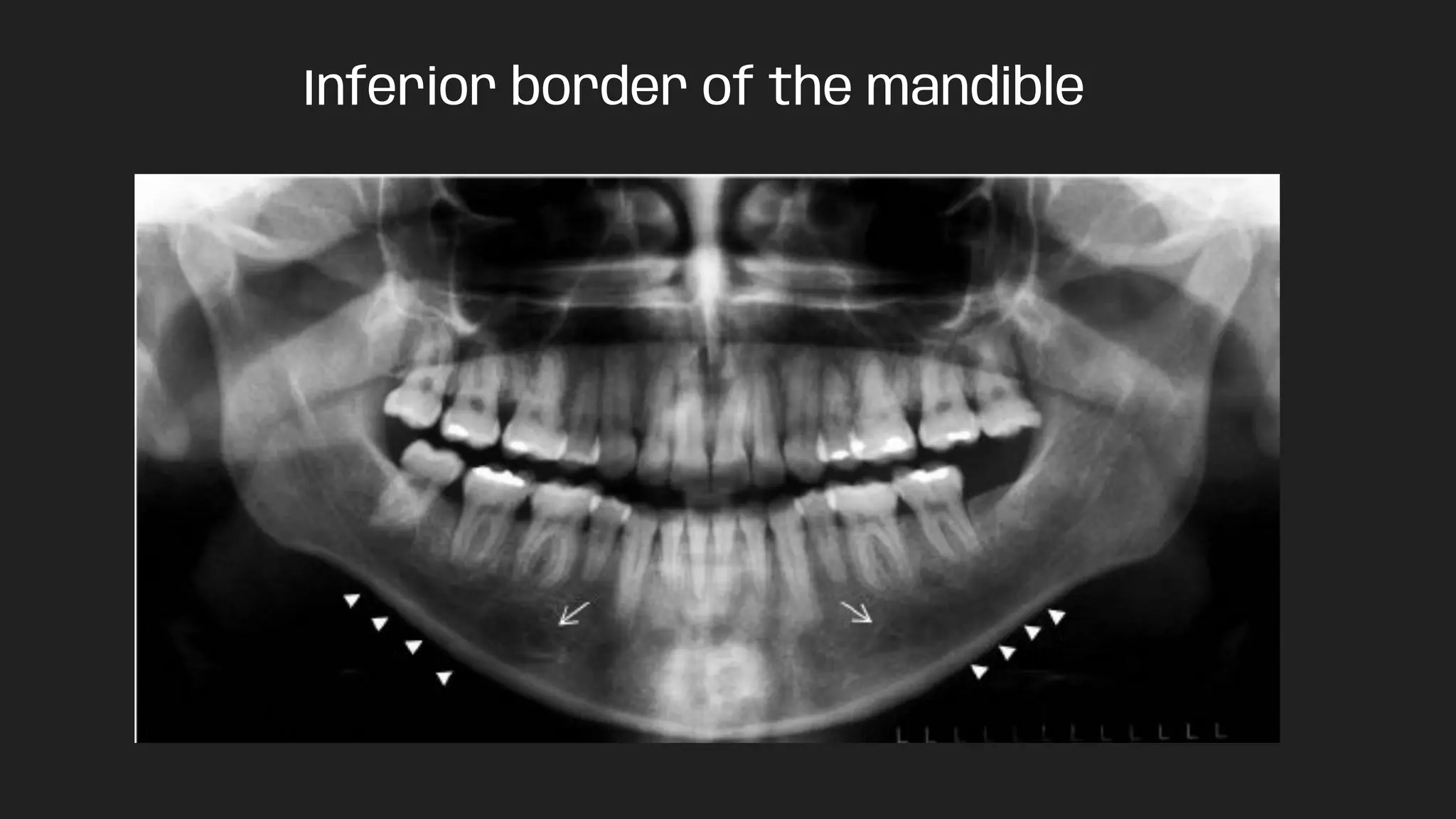 PANORAMIC RADIOGRAPHS .pdf