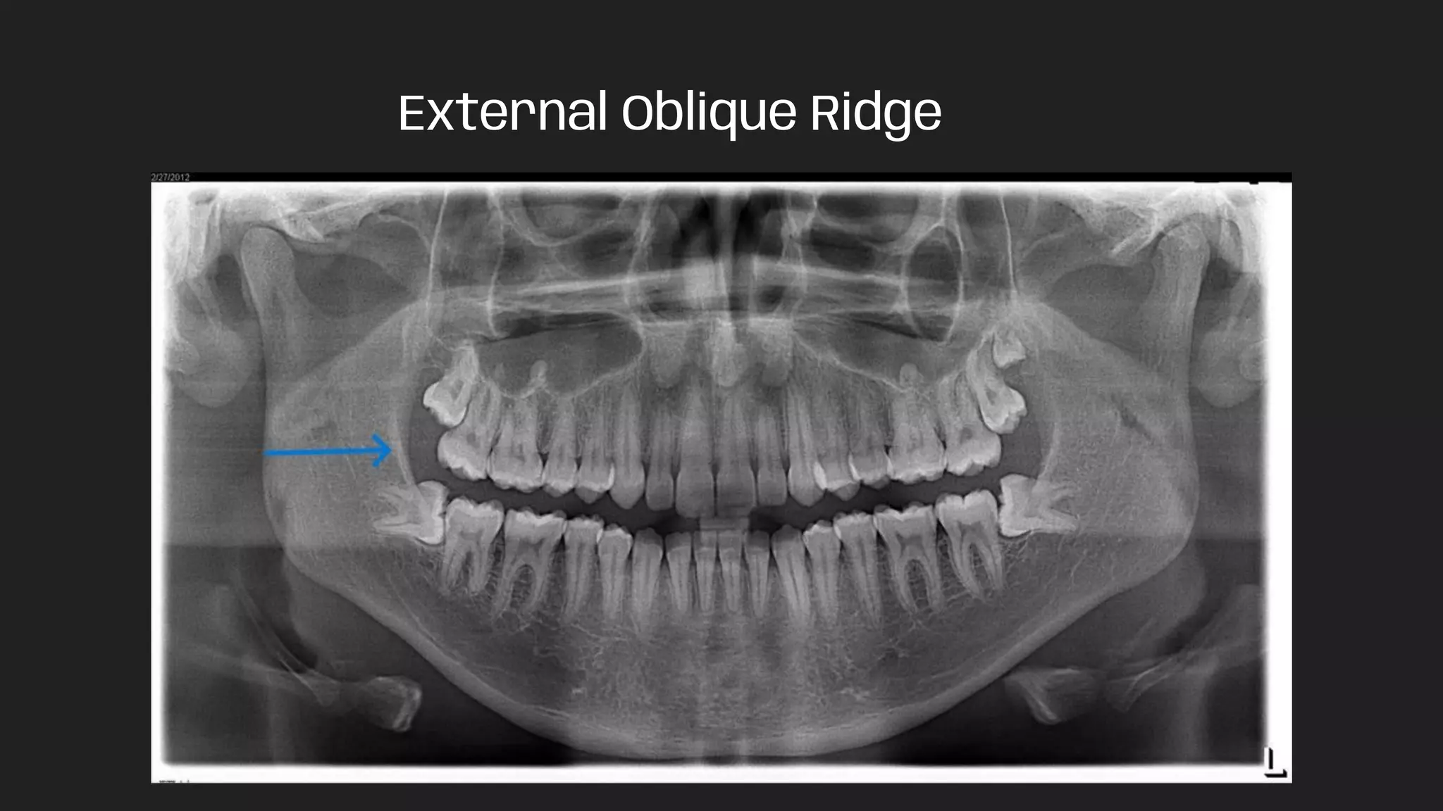 PANORAMIC RADIOGRAPHS .pdf