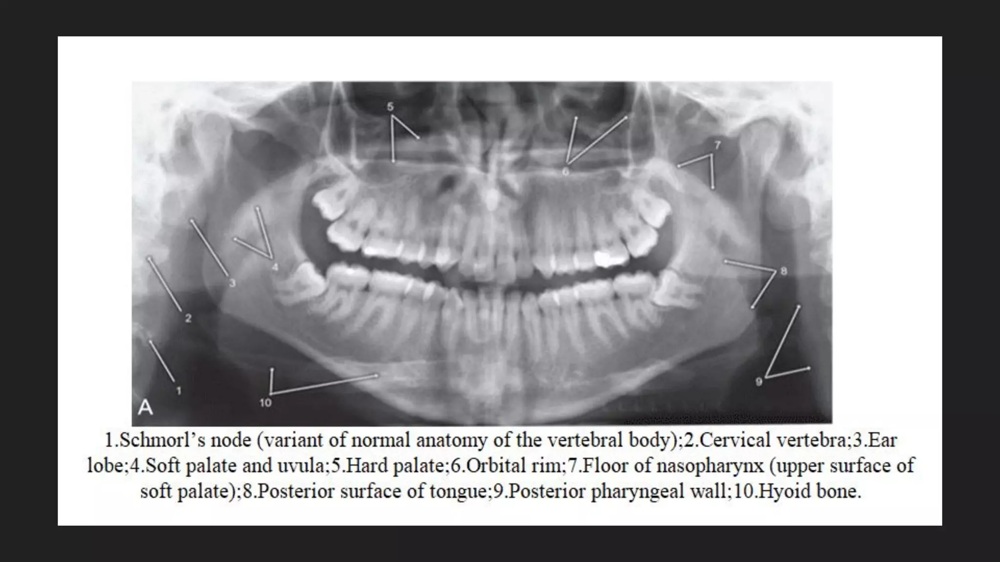 PANORAMIC RADIOGRAPHS .pdf
