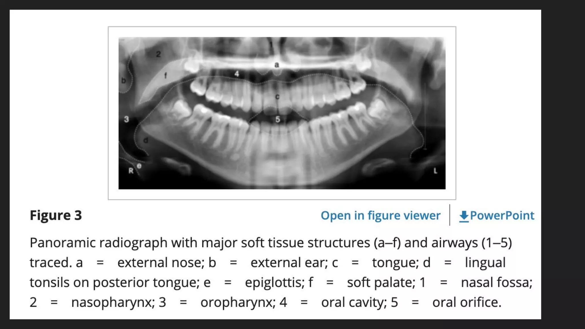 PANORAMIC RADIOGRAPHS .pdf