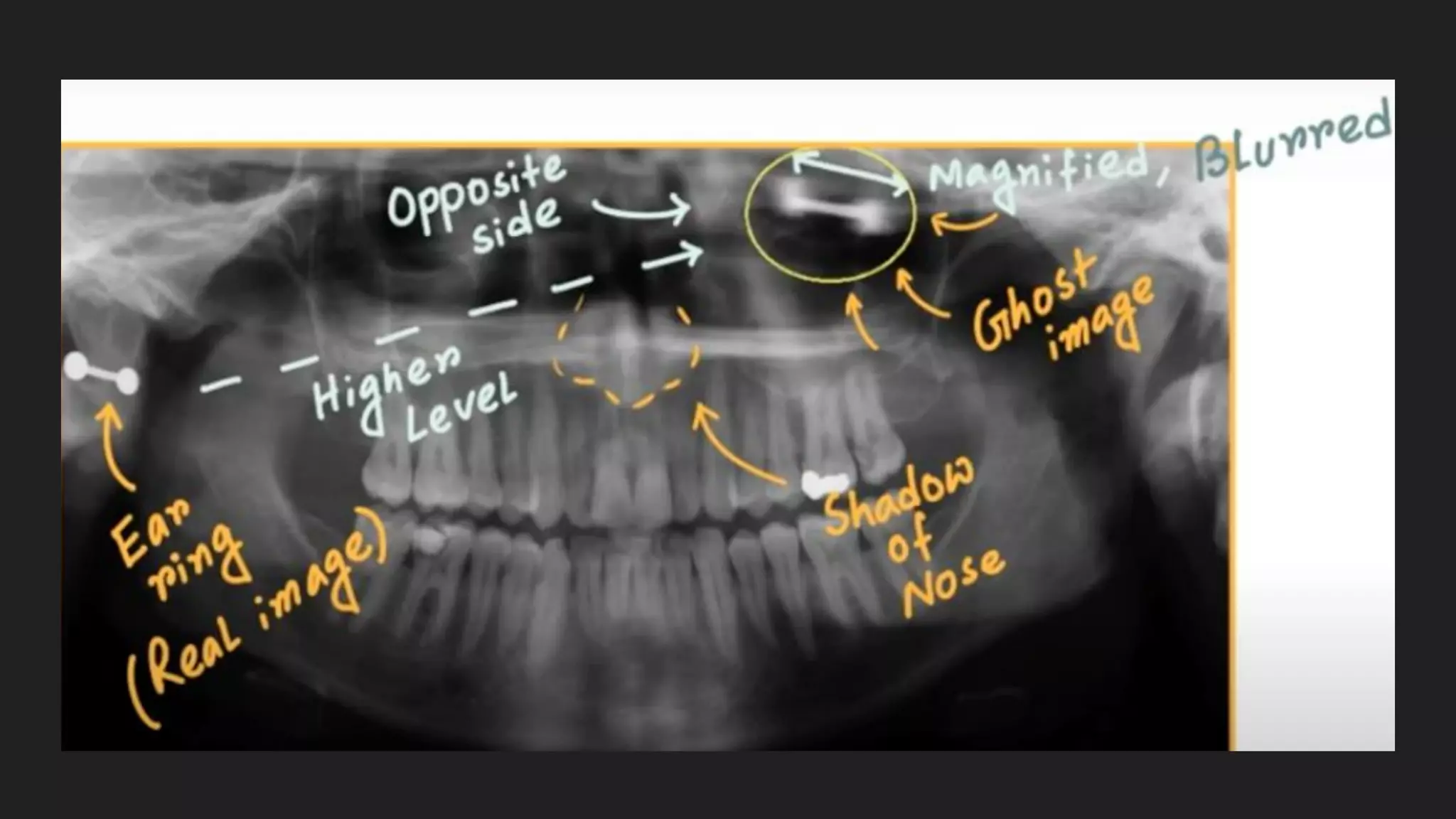 PANORAMIC RADIOGRAPHS .pdf