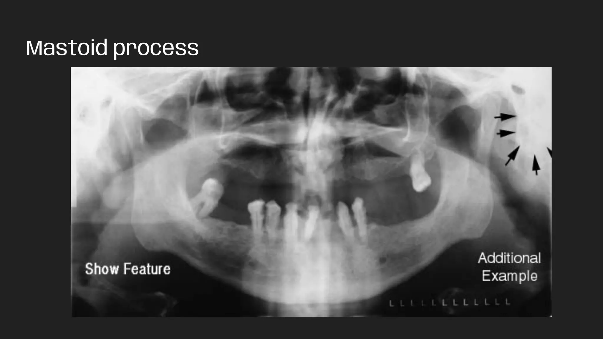 PANORAMIC RADIOGRAPHS .pdf