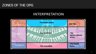 PANORAMIC RADIOGRAPHS .pdf