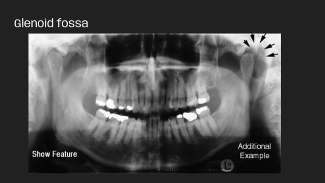 PANORAMIC RADIOGRAPHS .pdf