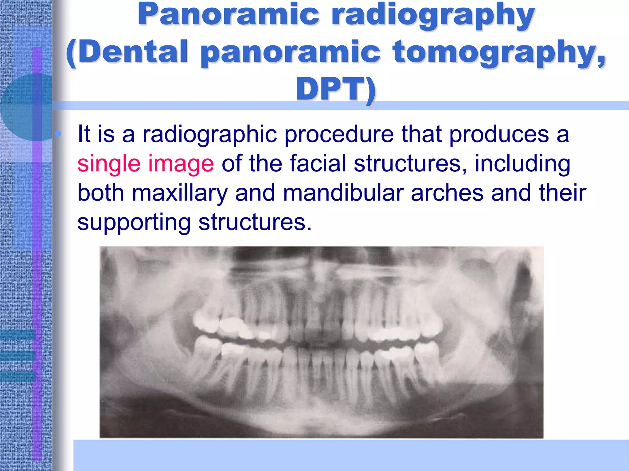 Panoramic Radiography | PPT