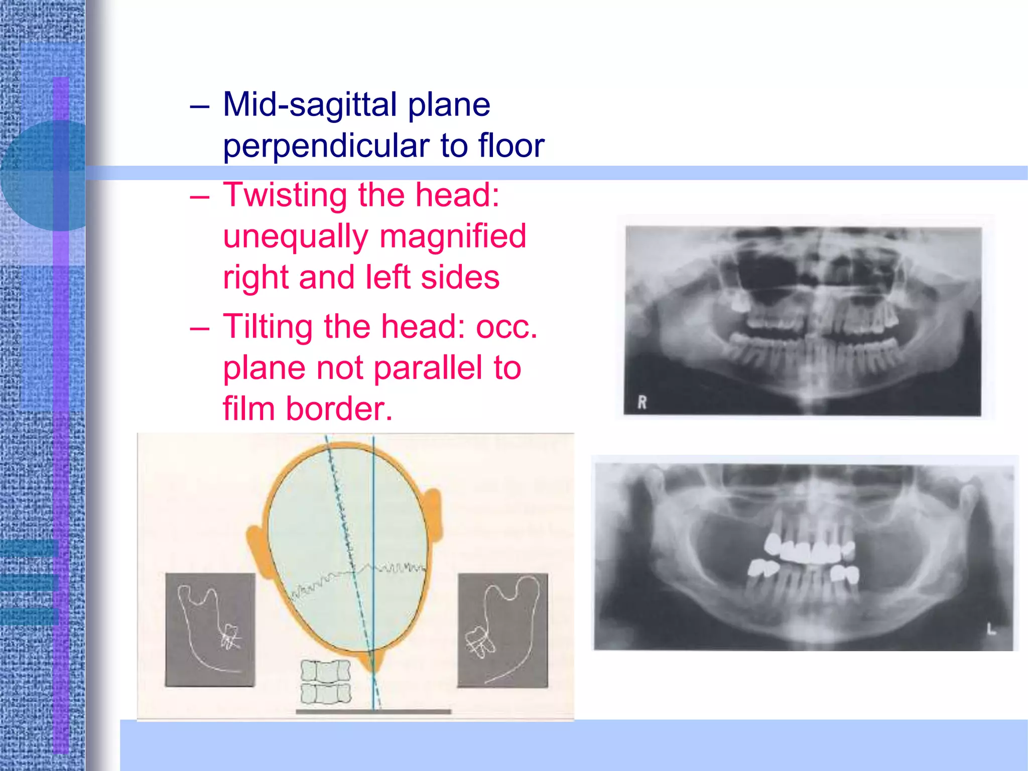 Panoramic Radiography | PPSX