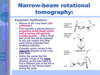 Panoramic Radiography | PPSX