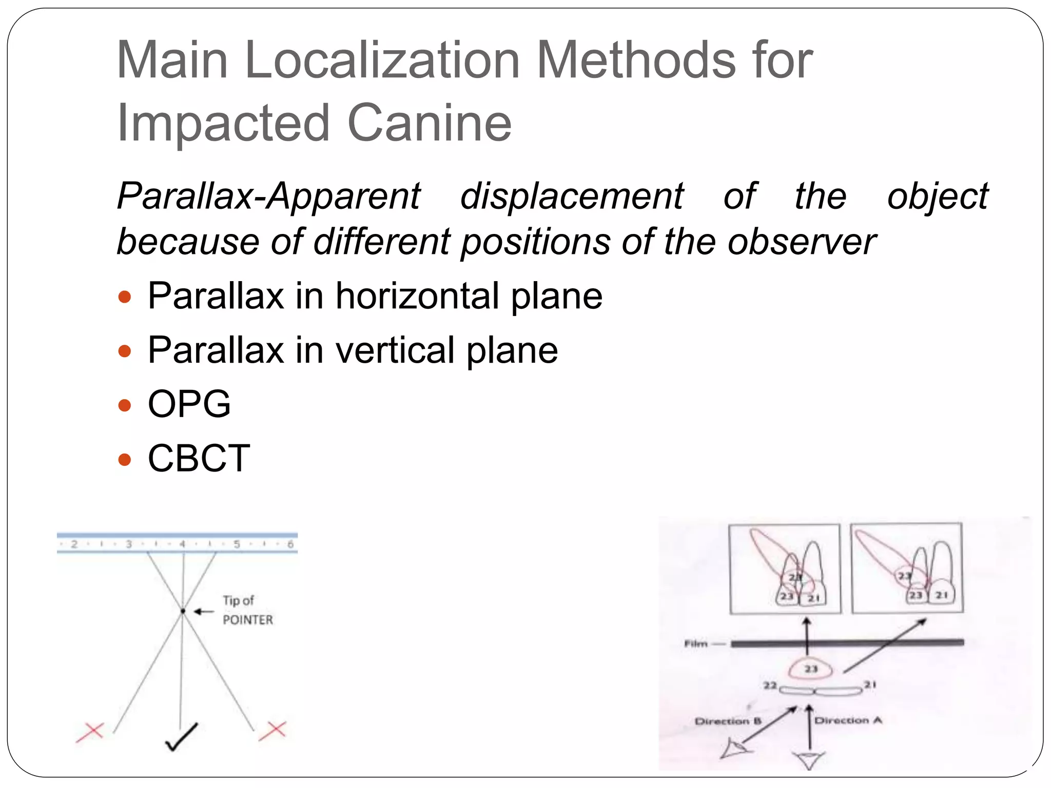 Panoramic radiography (dental panoramic tomography dpt) and periapical ...