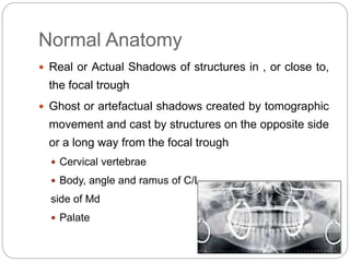 Panoramic radiography (dental panoramic tomography dpt) and periapical ...