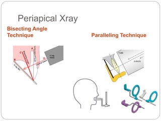 Panoramic radiography (dental panoramic tomography dpt) and periapical ...