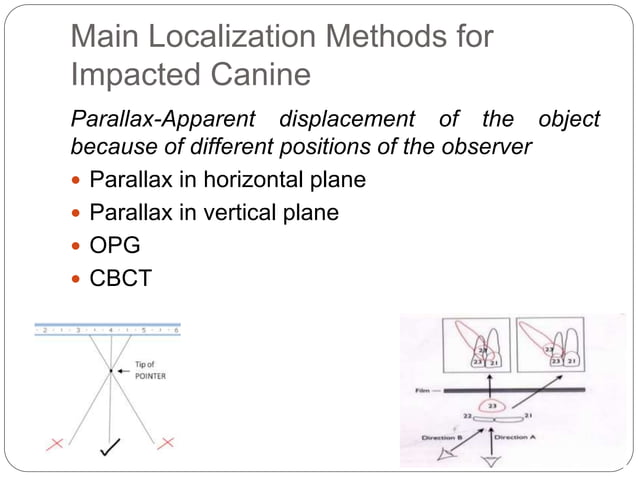 Panoramic radiography (dental panoramic tomography dpt) and periapical ...