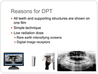 Panoramic radiography (dental panoramic tomography dpt) and periapical ...