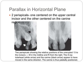 Panoramic radiography (dental panoramic tomography dpt) and periapical ...