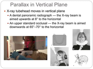 Panoramic radiography (dental panoramic tomography dpt) and periapical ...