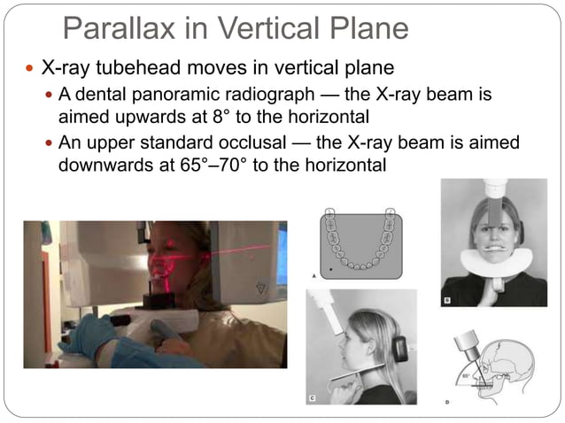 Panoramic radiography (dental panoramic tomography dpt) and periapical ...