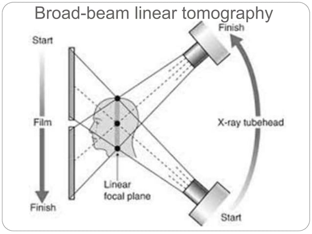 Panoramic radiography (dental panoramic tomography dpt) and periapical ...