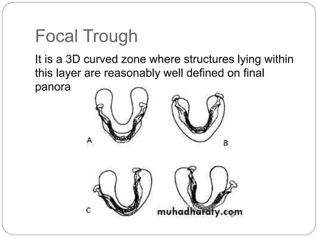 Panoramic radiography (dental panoramic tomography dpt) and periapical ...