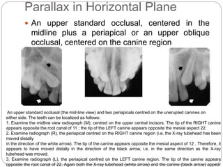 Panoramic radiography (dental panoramic tomography dpt) and periapical ...
