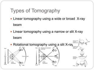 Panoramic radiography (dental panoramic tomography dpt) and periapical ...