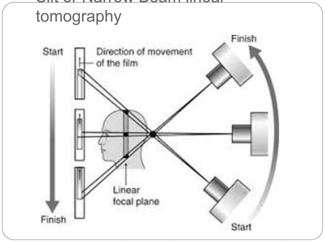 Panoramic radiography (dental panoramic tomography dpt) and periapical ...