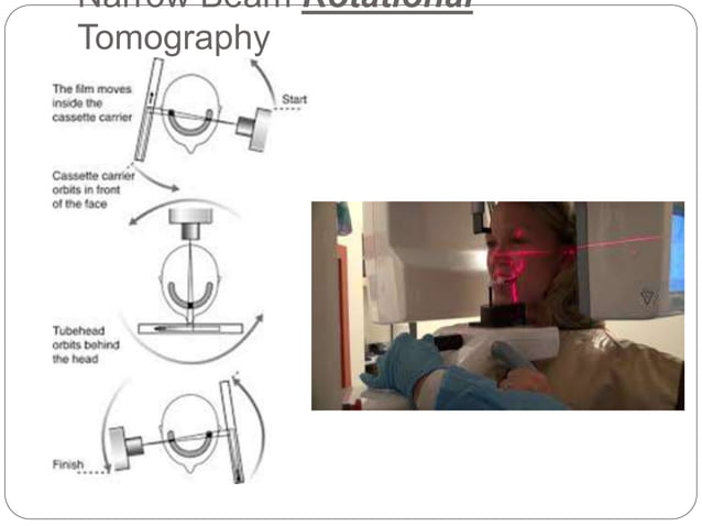 Panoramic radiography (dental panoramic tomography dpt) and periapical ...